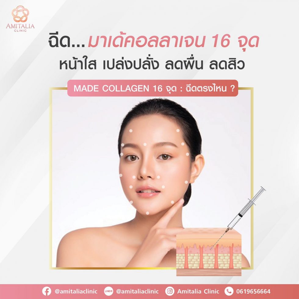 รักษาสิวด้วย Made Collagen ที่ Amitalia clinic - Amitalia clinic